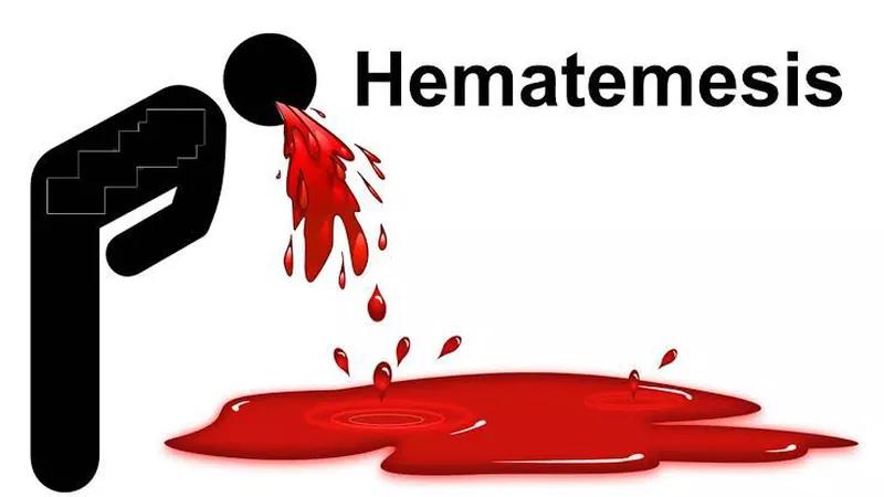 Hematemesis: Causas, Síntomas Y Tratamiento | Doctor Online