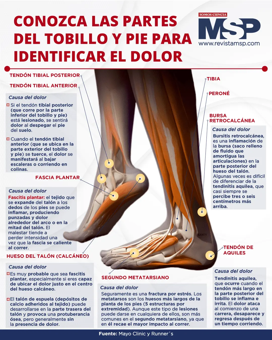 Esguince De Tobillo: Síntomas, Causas, Tratamiento Y Prevención ...