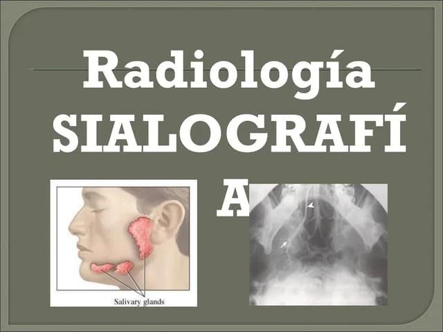 Sialografía Sobre Su Procedimiento, Usos Y Resultados | Doctor Online