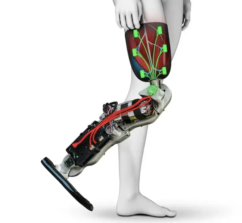 Prótesis De Piernas Modernas De Precios, Tipos Y Tecnología | Doctor Online