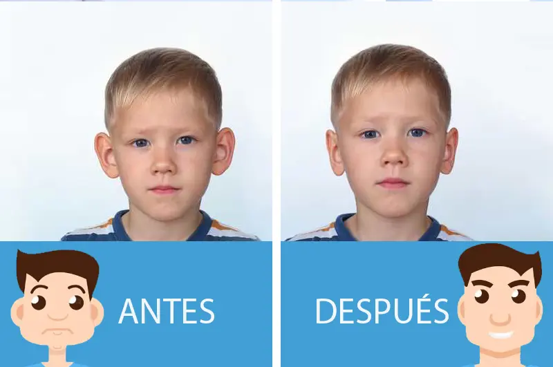 Cirugía De Orejas: Costo Y Factores A Considerar | Doctor Online