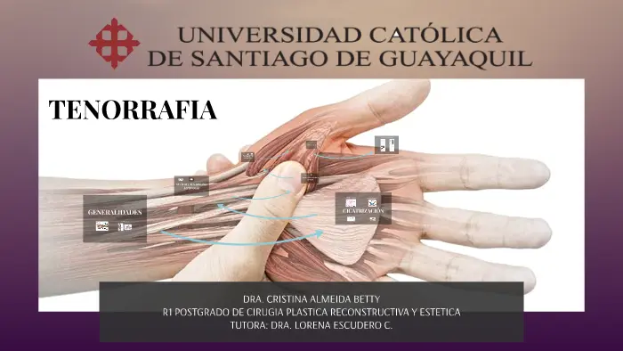 La Tenorrafia: Reparación De Tendones De La Mano Y Su Tiempo De ...