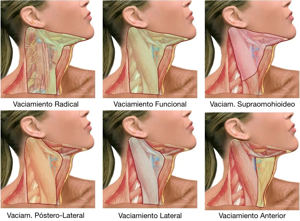 Ganglios Cervicales Inflamados: Causas, Síntomas Y Diagnóstico | Doctor ...