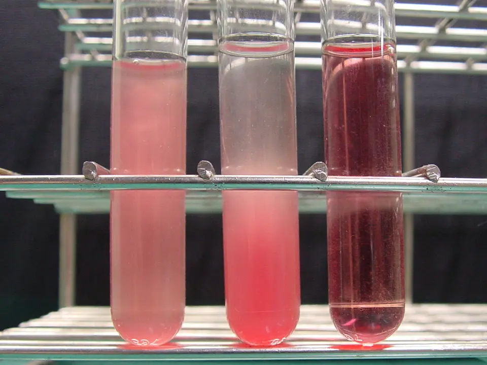 Hemólisis: Causas, Detección Y Significado En Pruebas De Laboratorio ...