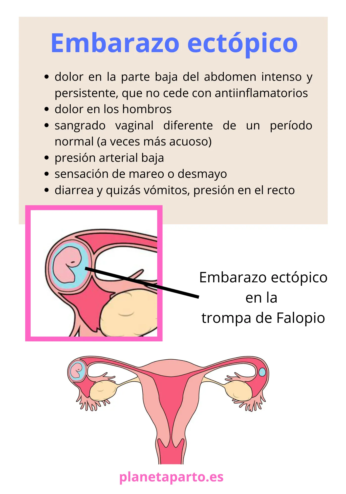 Embarazo Ectópico: Síntomas Tempranos Y Todo Lo Que Necesitas Saber ...