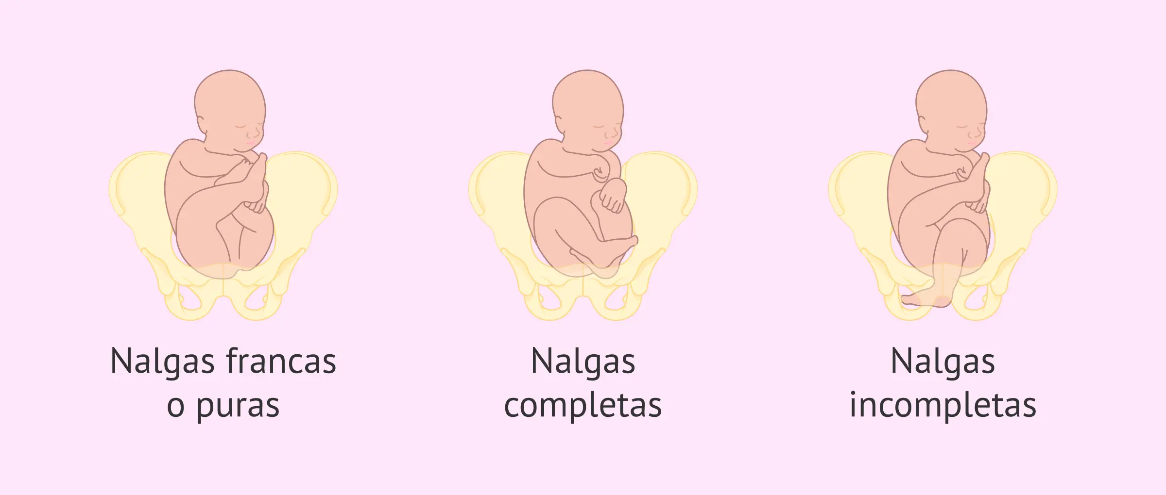Presentación Podálica: ¿Qué Es Y Cómo Manejarla? | Doctor Online