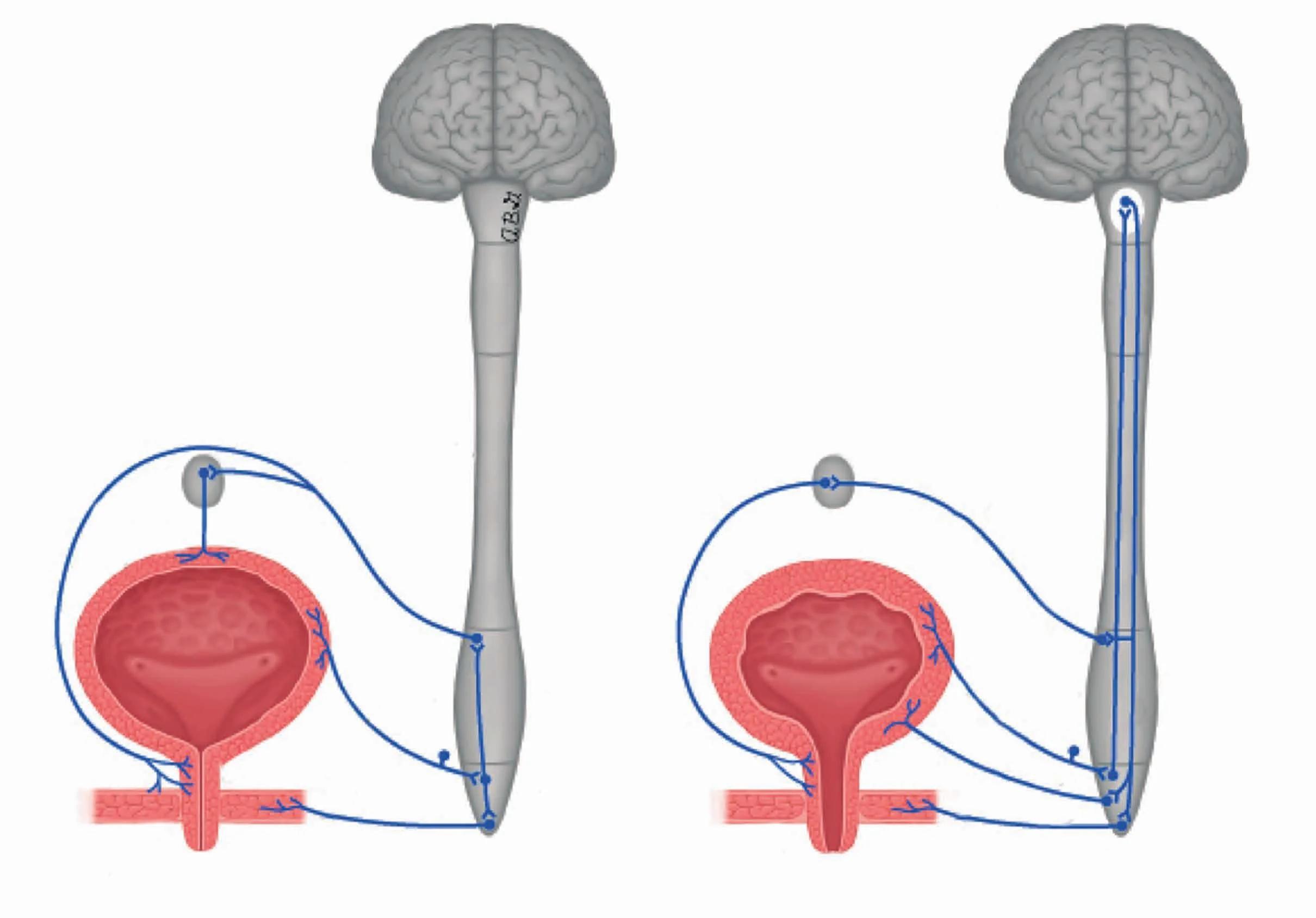 Tenesmo Vesical: Causas, Síntomas Y Tratamiento | Doctor Online