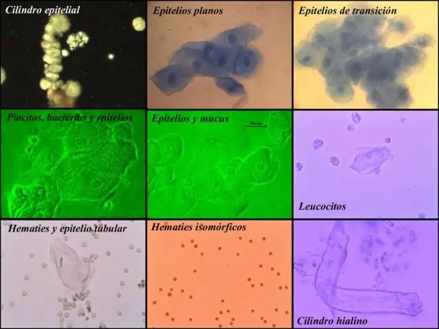 Mucus Abundante En Orina: Causas, Síntomas Y Cuándo Preocuparse ...