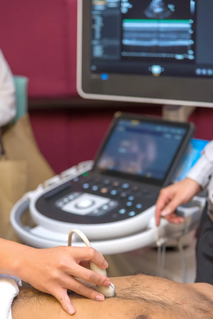 Cavidad Peritoneal: Anatomía, Funciones Y Trastornos | Doctor Online