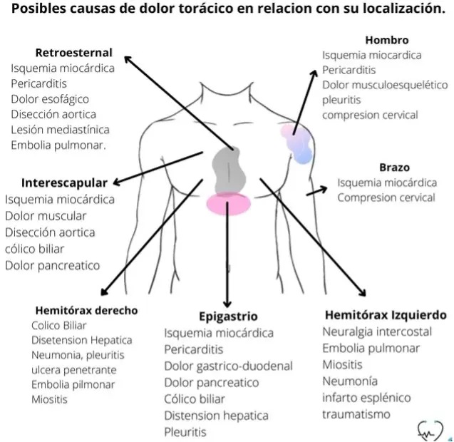 Dolor Torácico Opresivo: Causas, Síntomas Y Tratamiento | Doctor Online