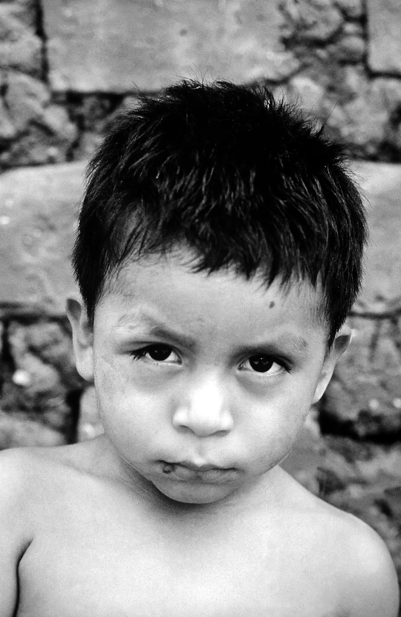 Chagoma De Inoculación: Qué Es Y Cómo Prevenirlo | Doctor Online