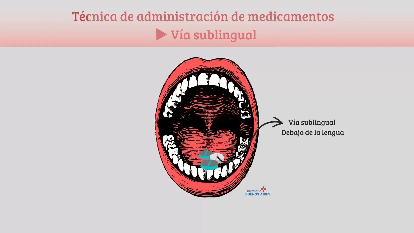 ¿Qué Pasa Si Me Trago Una Pastilla Sublingual? | Doctor Online