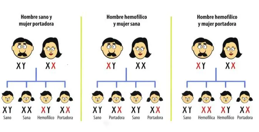 Hemofilia En Mujeres: Un Diagnóstico Crucial Y Sus Implicaciones ...
