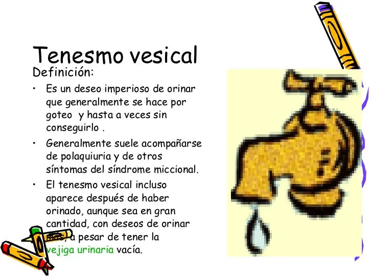 Tenesmo Vesical: Causas, Síntomas Y Tratamiento | Doctor Online
