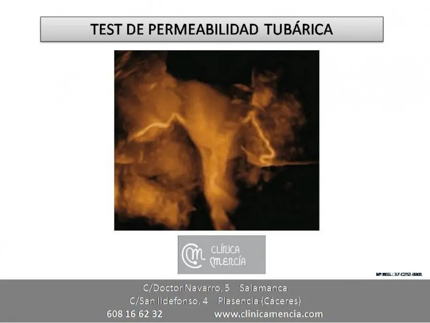 Prueba De Cotte Positiva: ¿Qué Es Y Cómo Puede Ayudarte A Quedar ...